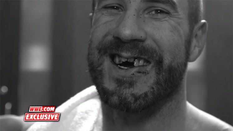 Video: Cesaro receives stitches before emergency dental work at No ...