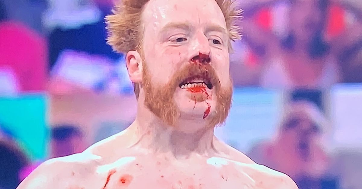WWE Superstar Sheamus underwent second nose surgery on Wednesday - WWE ...