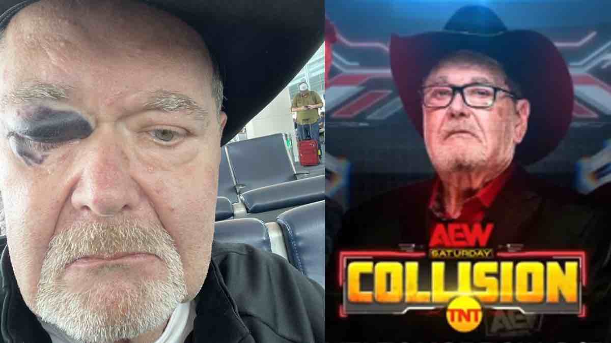Despite suffering a black eye, Jim Ross says he'll still be at tonight ...