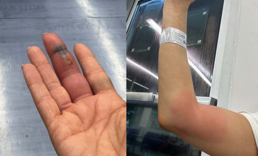 Miro provides an update on CJ Perry following surgery for an infection ...