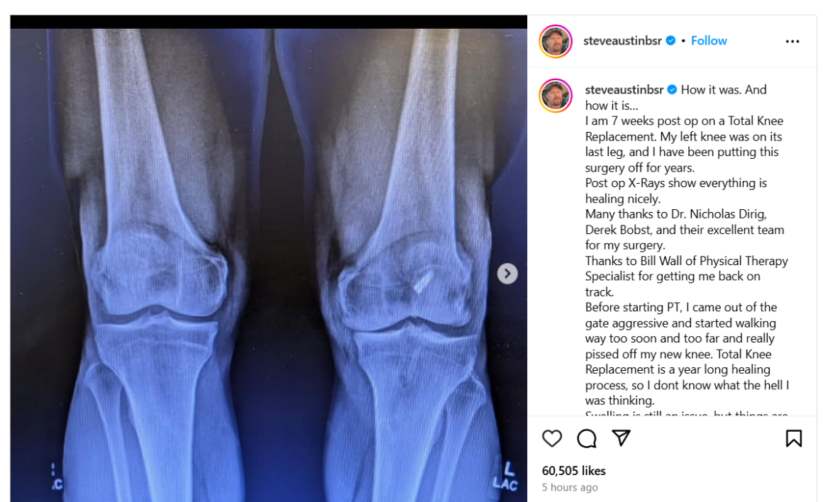 WWE Hall of Famer gives update following knee surgery - WWE News, WWE ...